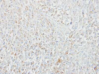 MIPEP Antibody (NBP1-32008) by Novus, Part of Bio-Techne