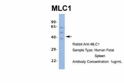MLC1 Antibody - BSA Free (NBP1-80073) by Novus, Part of Bio-Techne