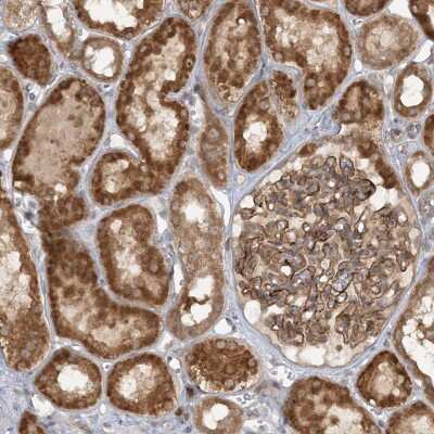 MMADHC Antibody - BSA Free (NBP2-38351) by Novus, Part of Bio-Techne