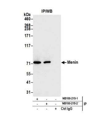 Menin Antibody - BSA Free (NB100-215) by Novus, Part of Bio-Techne