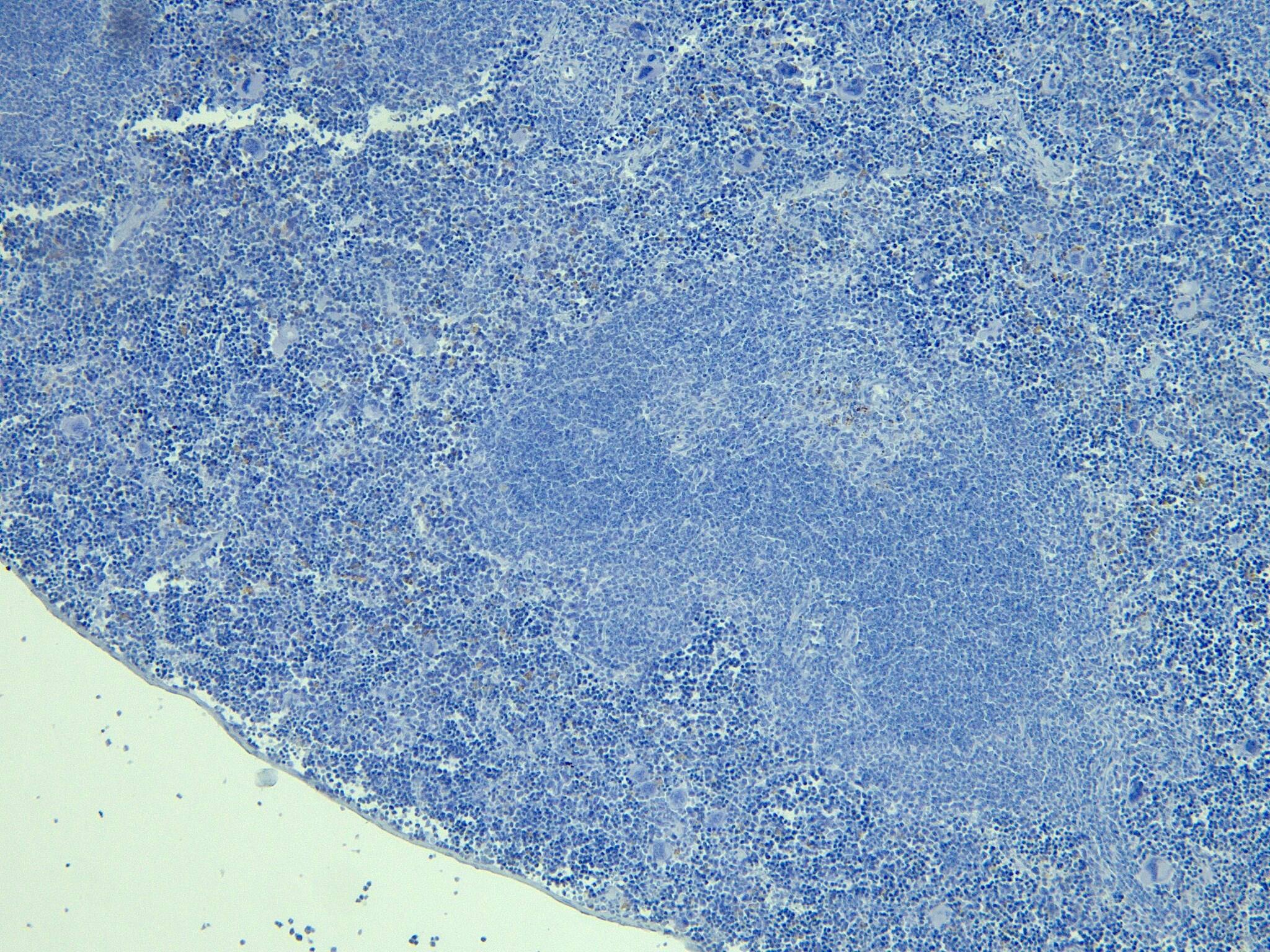 FoxP3 Antibody (NB600-243) by Novus, Part of Bio-Techne