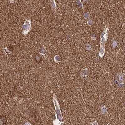 NFS1 Antibody - BSA Free (NBP2-38737) by Novus, Part of Bio-Techne