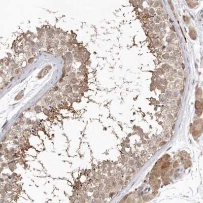 NSUN4 Antibody - BSA Free (NBP1-82733) by Novus, Part of Bio-Techne