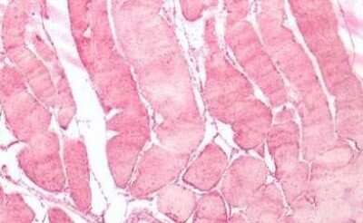 Neuromedin UR2/NMUR2 Antibody - BSA Free (NBP1-02351) by Novus, Part of ...