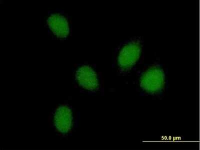 PHF16 Antibody - Azide and BSA Free (H00009767-B01P) by Novus, Part of Bio-Techne