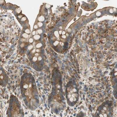 PI 4 Kinase type 2 beta Antibody (NBP1-87908) by Novus, Part of Bio-Techne