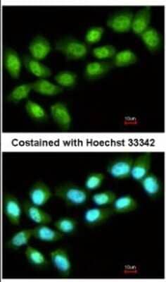 PRMT5 Antibody (NBP2-19937) | Bio-Techne