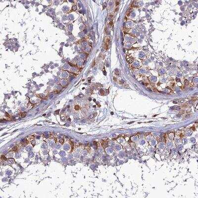PSMD11 Antibody - BSA Free (NBP1-82700) by Novus, Part of Bio-Techne