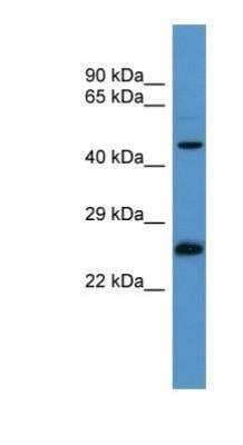 RAB8B Antibody - BSA Free (NBP1-68974) by Novus, Part of Bio-Techne