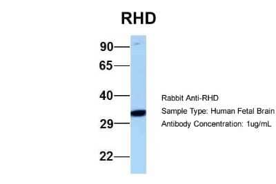 RHD Antibody - BSA Free (NBP2-84247) by Novus, Part of Bio-Techne