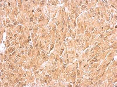 RIN2 Antibody (NBP2-20163) by Novus, Part of Bio-Techne