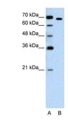 ROR alpha/NR1F1 Antibody - BSA Free (NBP1-52828) by Novus, Part of Bio ...