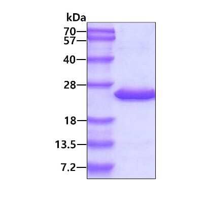 Recombinant Human GRP His Protein (NBP1-72445) | Bio-Techne