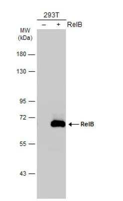RelB Antibody (NBP2-20123) by Novus, Part of Bio-Techne
