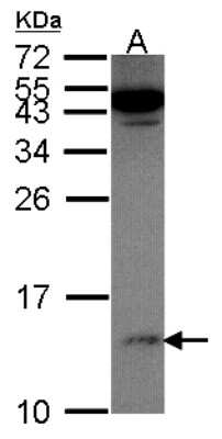 S100A11 Antibody (NBP1-32998) by Novus, Part of Bio-Techne