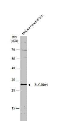 SLC25A1 Antibody (NBP1-31851) by Novus, Part of Bio-Techne