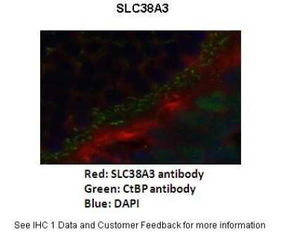 SLC38A3 Antibody (NBP1-60103) by Novus, Part of Bio-Techne