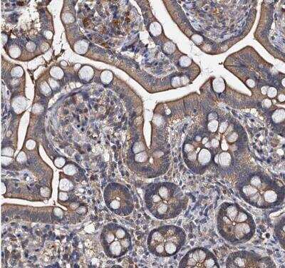 SLC46A3 Antibody - BSA Free (NBP1-85054) by Novus, Part of Bio-Techne