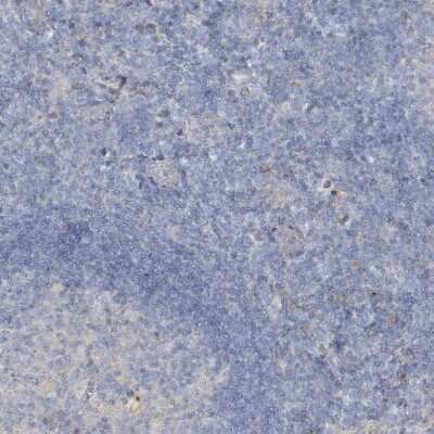 SLC4A10 Antibody - BSA Free (NBP1-82594) by Novus, Part of Bio-Techne