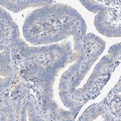 SLC4A10 Antibody - BSA Free (NBP1-82594) by Novus, Part of Bio-Techne