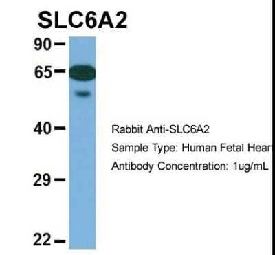 SLC6A2/NET/Noradrenaline transporter Antibody - BSA Free (NBP1-60120) by Novus, Part of Bio-Techne
