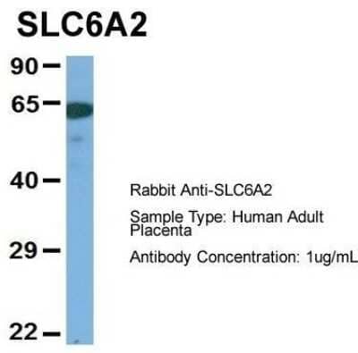 SLC6A2/NET/Noradrenaline transporter Antibody - BSA Free (NBP1-60120) by Novus, Part of Bio-Techne
