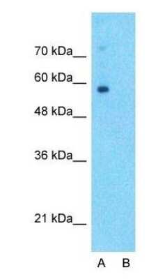 SLC6A2/NET/Noradrenaline transporter Antibody - BSA Free (NBP1-60120) by Novus, Part of Bio-Techne