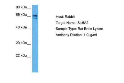SLC6A2/NET/Noradrenaline transporter Antibody - BSA Free (NBP2-85762) by Novus, Part of Bio-Techne
