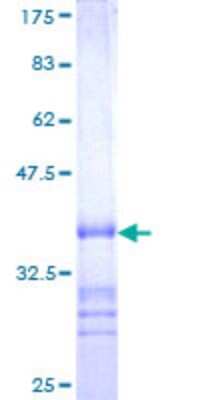 Recombinant Human SMA4 GST (N-Term) Protein (H00011039-Q01) by Novus ...