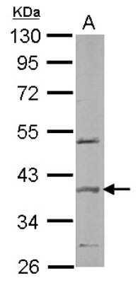 SPOP Antibody (NBP1-33090) by Novus, Part of Bio-Techne