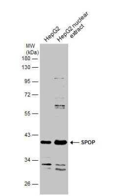 SPOP Antibody (NBP1-33090) | Bio-Techne