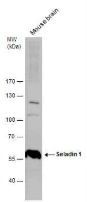 Seladin 1 Antibody (NBP1-32247) | Bio-Techne