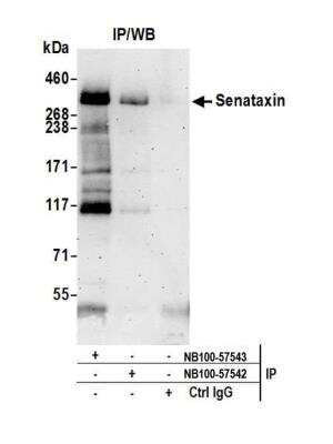 Senataxin Antibody - BSA Free (NB100-57543) by Novus, Part of Bio-Techne