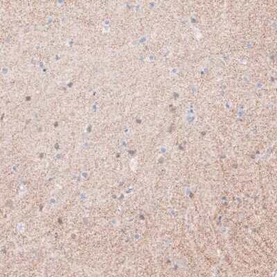 Synaptopodin Antibody (NBP1-87887) | Bio-Techne