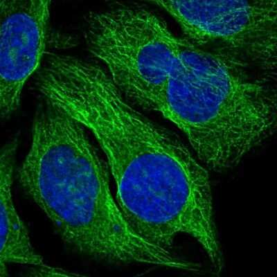 TBCA Antibody - BSA Free (NBP1-86288) by Novus, Part of Bio-Techne