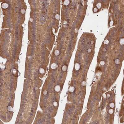 TBCA Antibody - BSA Free (NBP1-86288) by Novus, Part of Bio-Techne