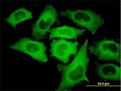 TIPIN Antibody (1G11) - Azide and BSA Free (H00054962-M01) by Novus ...