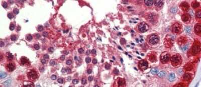 TKTL1 Antibody - BSA Free (NBP1-54864) by Novus, Part of Bio-Techne