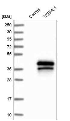 TREML1/TLT-1 Antibody - BSA Free (NBP1-84234) by Novus, Part of Bio-Techne