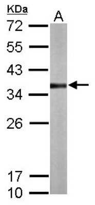 TST Antibody (NBP1-33771) | Bio-Techne