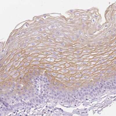 Transglutaminase 1/TGM1 Antibody - BSA Free (NBP2-34062) by Novus, Part ...