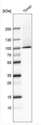 Transglutaminase 1/TGM1 Antibody - BSA Free (NBP2-34062) by Novus, Part ...