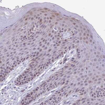 Transglutaminase 3/TGM3 Antibody (NBP1-86950) | Bio-Techne