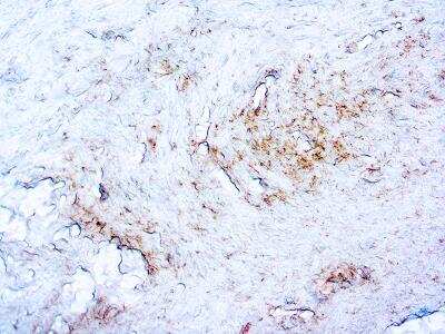 Treponema pallidum Products
