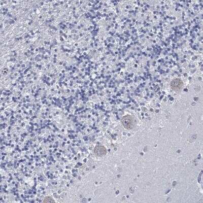 USP29 Antibody - BSA Free (NBP3-17070) by Novus, Part of Bio-Techne