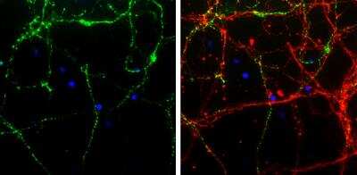 VIAAT/SLC32A1/VGAT Antibody - BSA Free (NBP2-20857) by Novus, Part of ...
