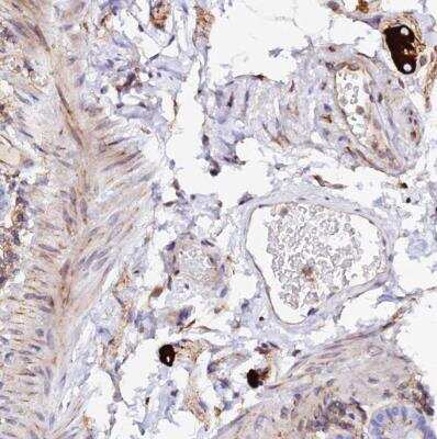 VRL1 Antibody - BSA Free (NBP1-92576) by Novus, Part of Bio-Techne