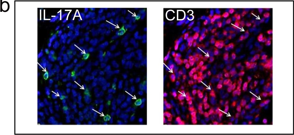 Human IL-17/IL-17A Antibody (AF-317-NA) by R&D Systems, Part of Bio-Techne