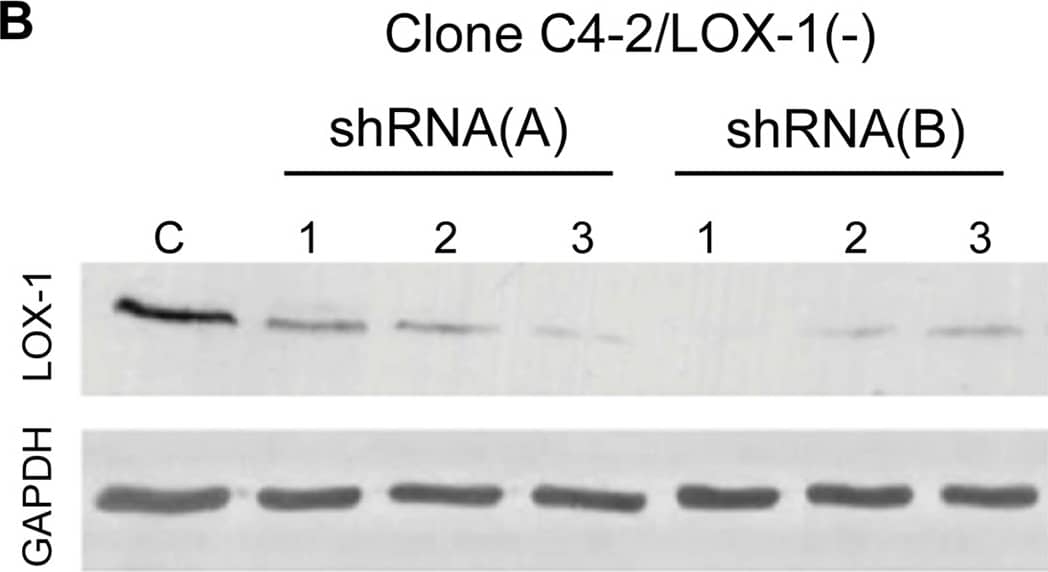 Human LOX-1/OLR1 Antibody (AF1798) by R&D Systems, Part of Bio-Techne