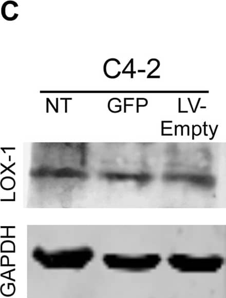 Human LOX-1/OLR1 Antibody (AF1798) by R&D Systems, Part of Bio-Techne